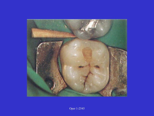 Clinical Diagnosis of Tooth Defects and Treatment Plan.ppt