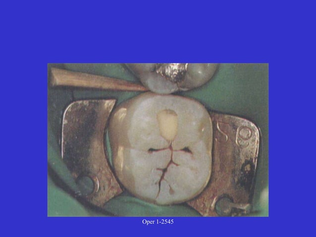 Clinical Diagnosis of Tooth Defects and Treatment Plan.ppt