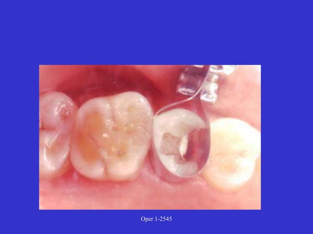 Clinical Diagnosis of Tooth Defects and Treatment Plan.ppt
