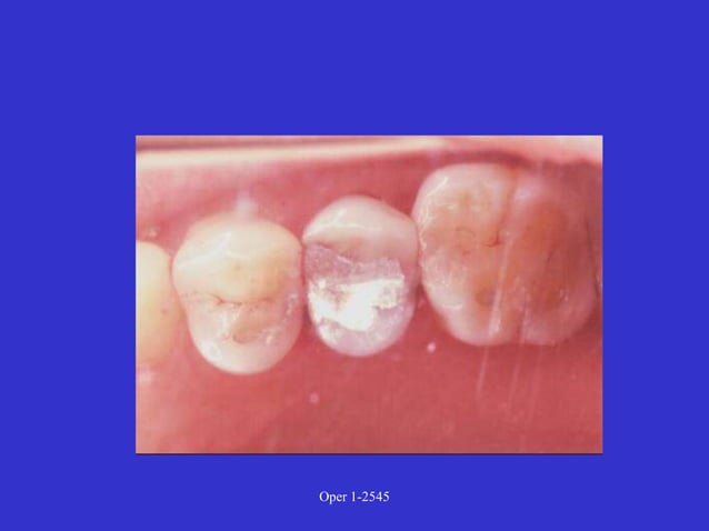 Clinical Diagnosis of Tooth Defects and Treatment Plan.ppt