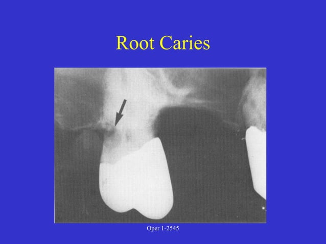 Clinical Diagnosis of Tooth Defects and Treatment Plan.ppt