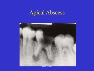 Clinical Diagnosis of Tooth Defects and Treatment Plan.ppt