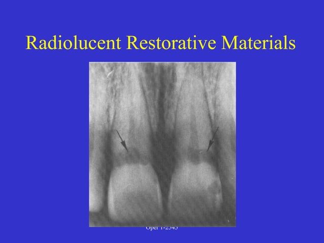 Clinical Diagnosis of Tooth Defects and Treatment Plan.ppt