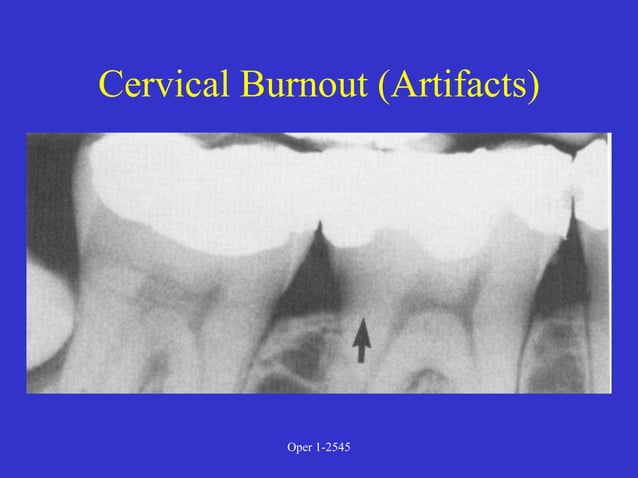 Clinical Diagnosis of Tooth Defects and Treatment Plan.ppt