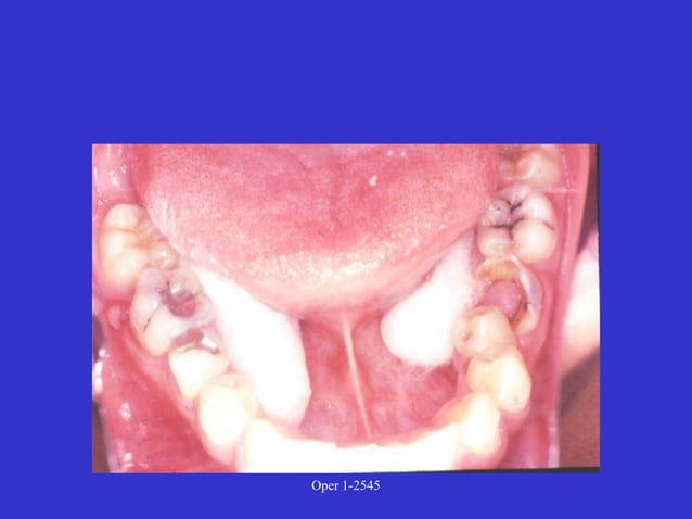 Clinical Diagnosis of Tooth Defects and Treatment Plan.ppt