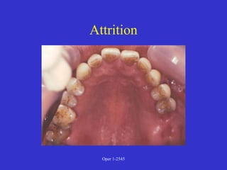 Clinical Diagnosis of Tooth Defects and Treatment Plan.ppt