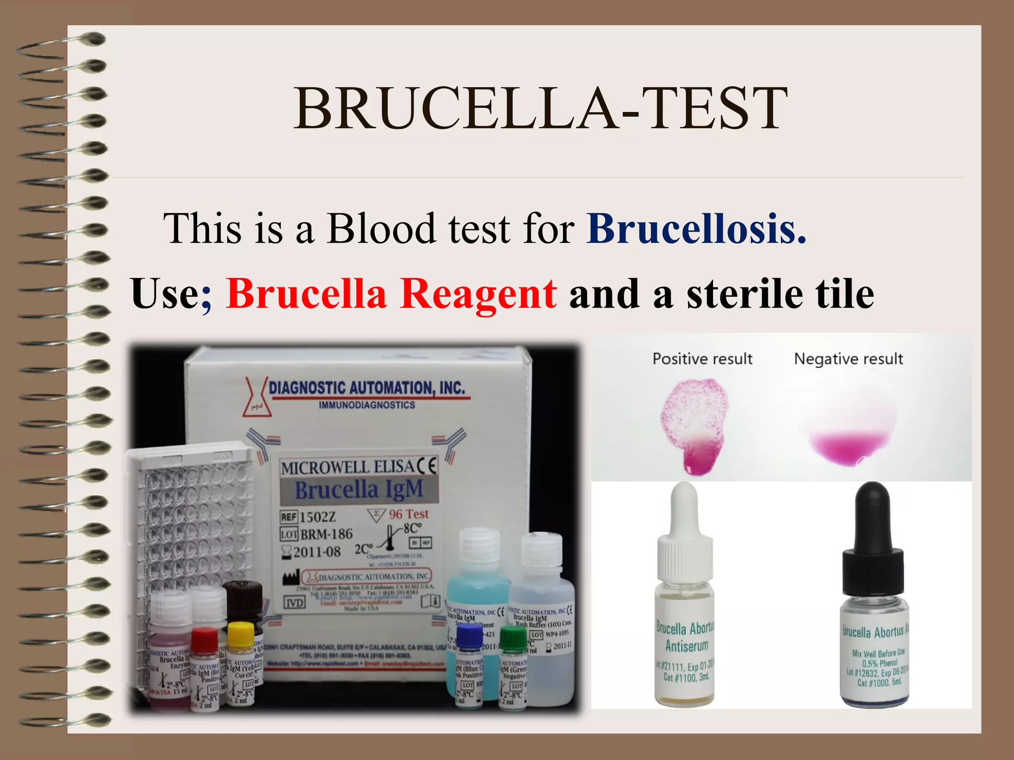 CLINICAL DIAGNOSTIC TESTS | PDF