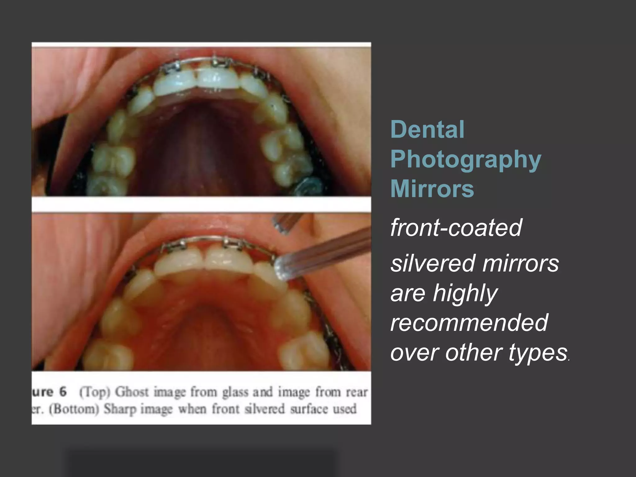 Clinical digital photography in orthodontics | PPTX