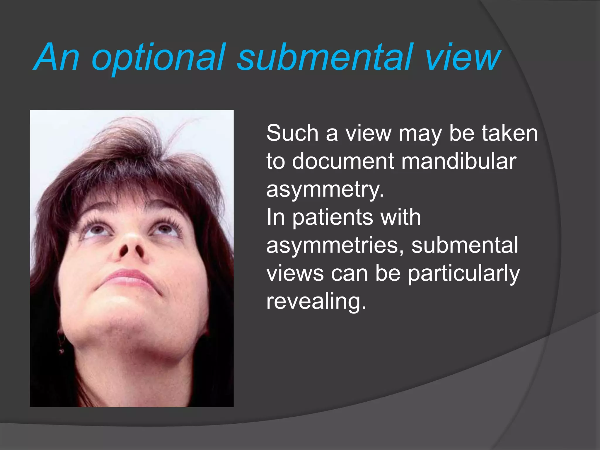 Clinical digital photography in orthodontics | PPTX