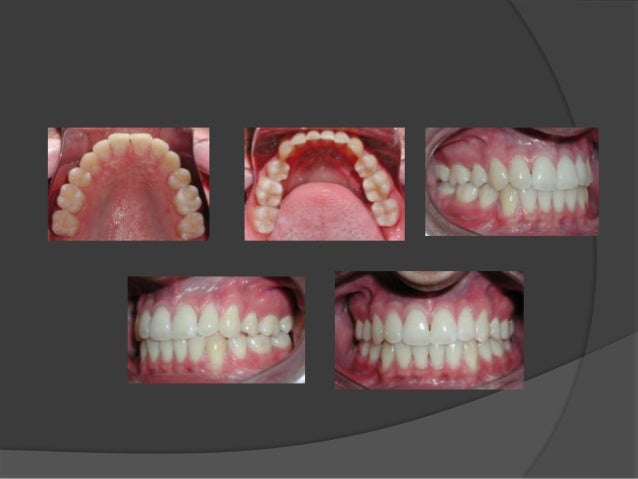 Clinical digital photography in orthodontics