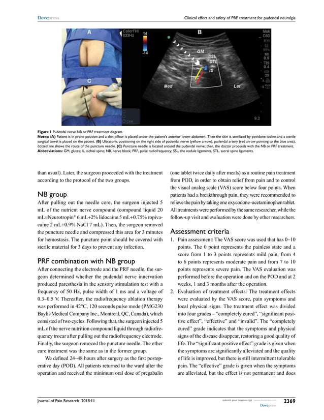 Clinical effect and safety of pulsed radiofrequency treatment for pudendal neuralgia: a ...