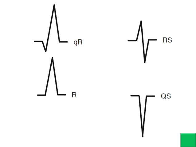 Clinical elecrocardiography 1 - Introduction | PPT