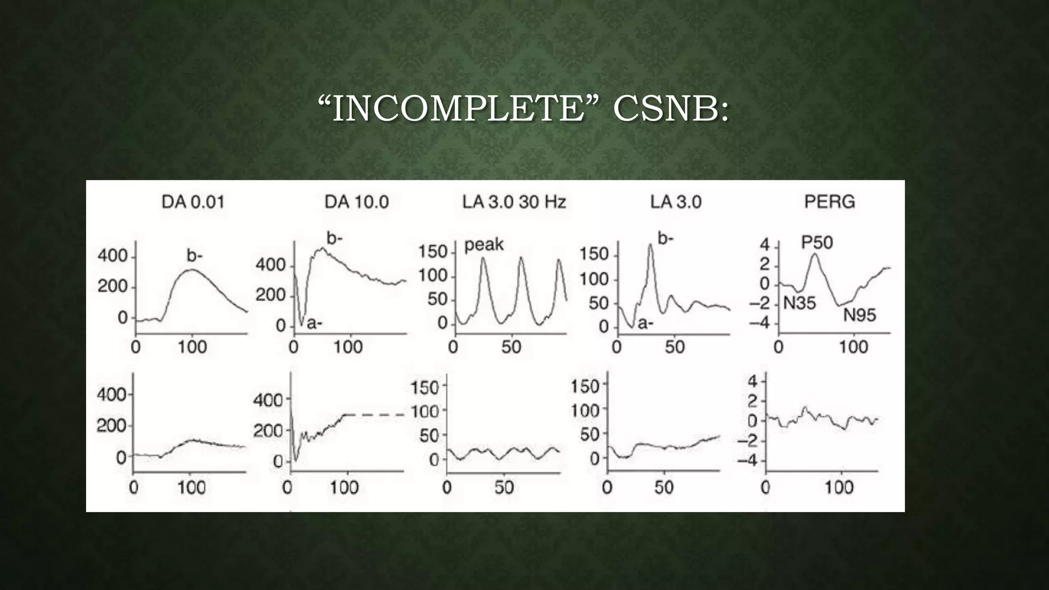 Clinical electrophysiology | PPTX