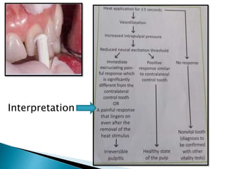 Clinical endodontic test | PPTX