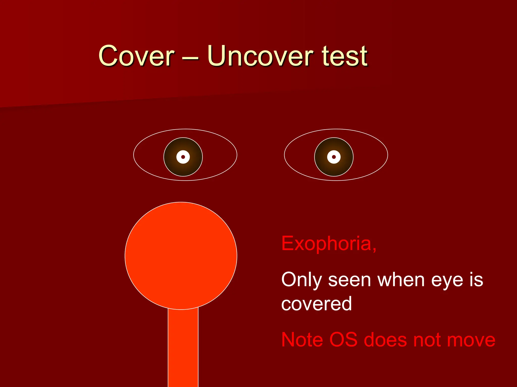power point presentation of Clinical evaluation of strabismus | PPTX