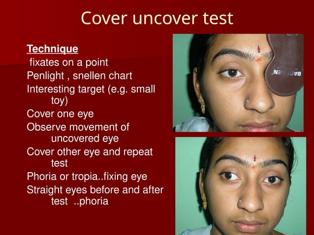 Clinical evaluation of strabismus patients.pptx
