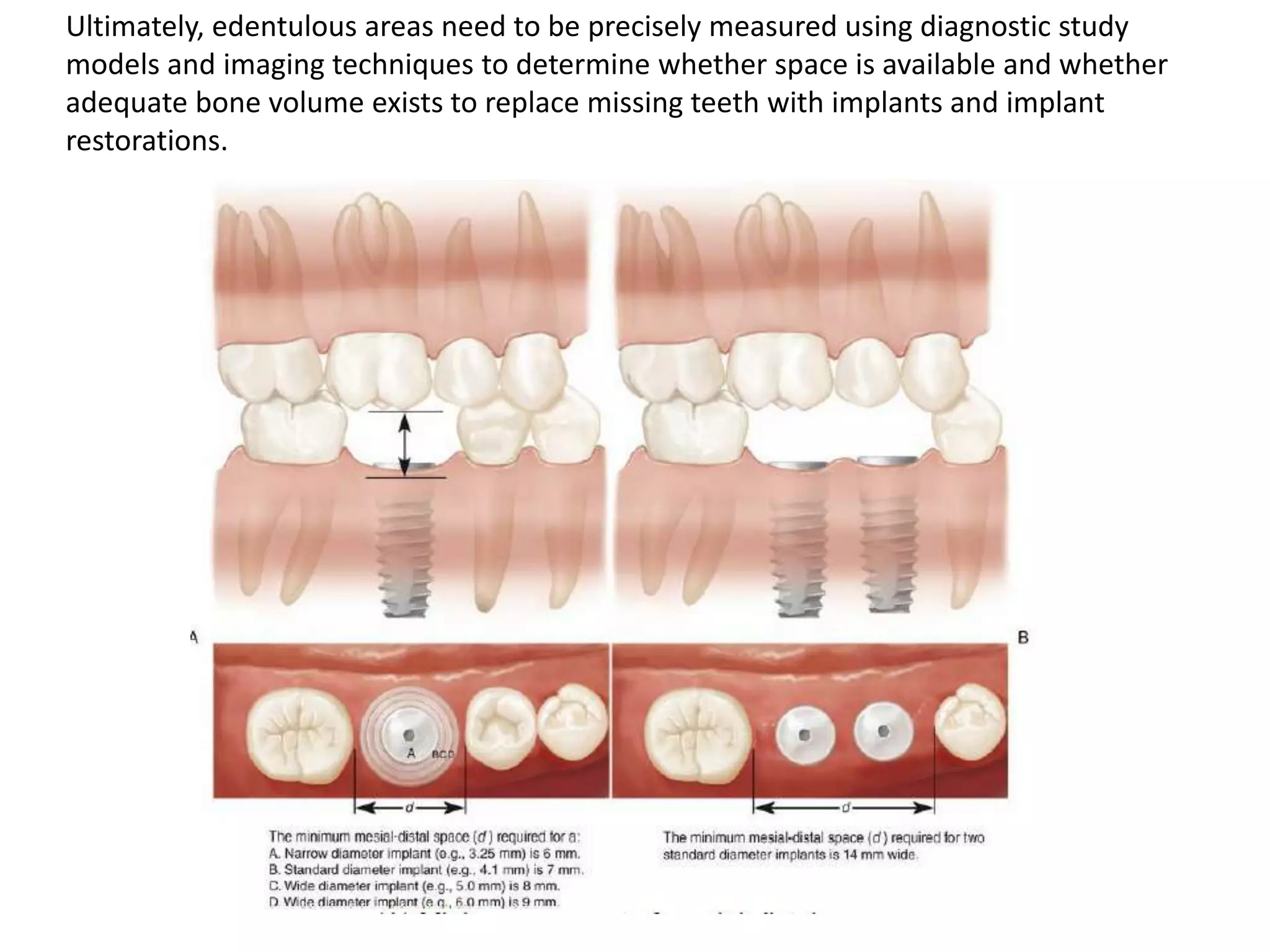 Clinical evaluation of the implant patient | PPTX