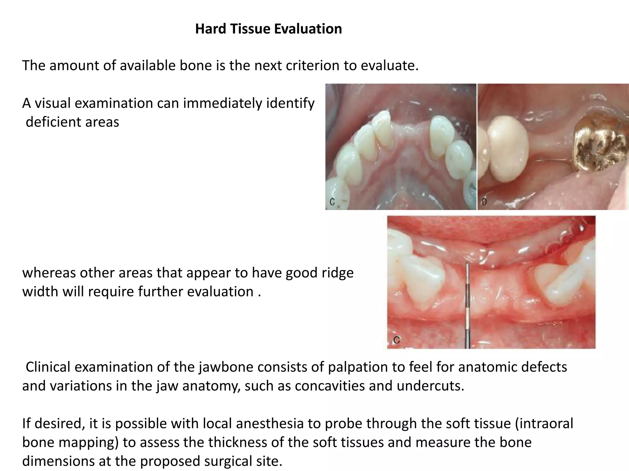 Clinical evaluation of the implant patient | PPTX