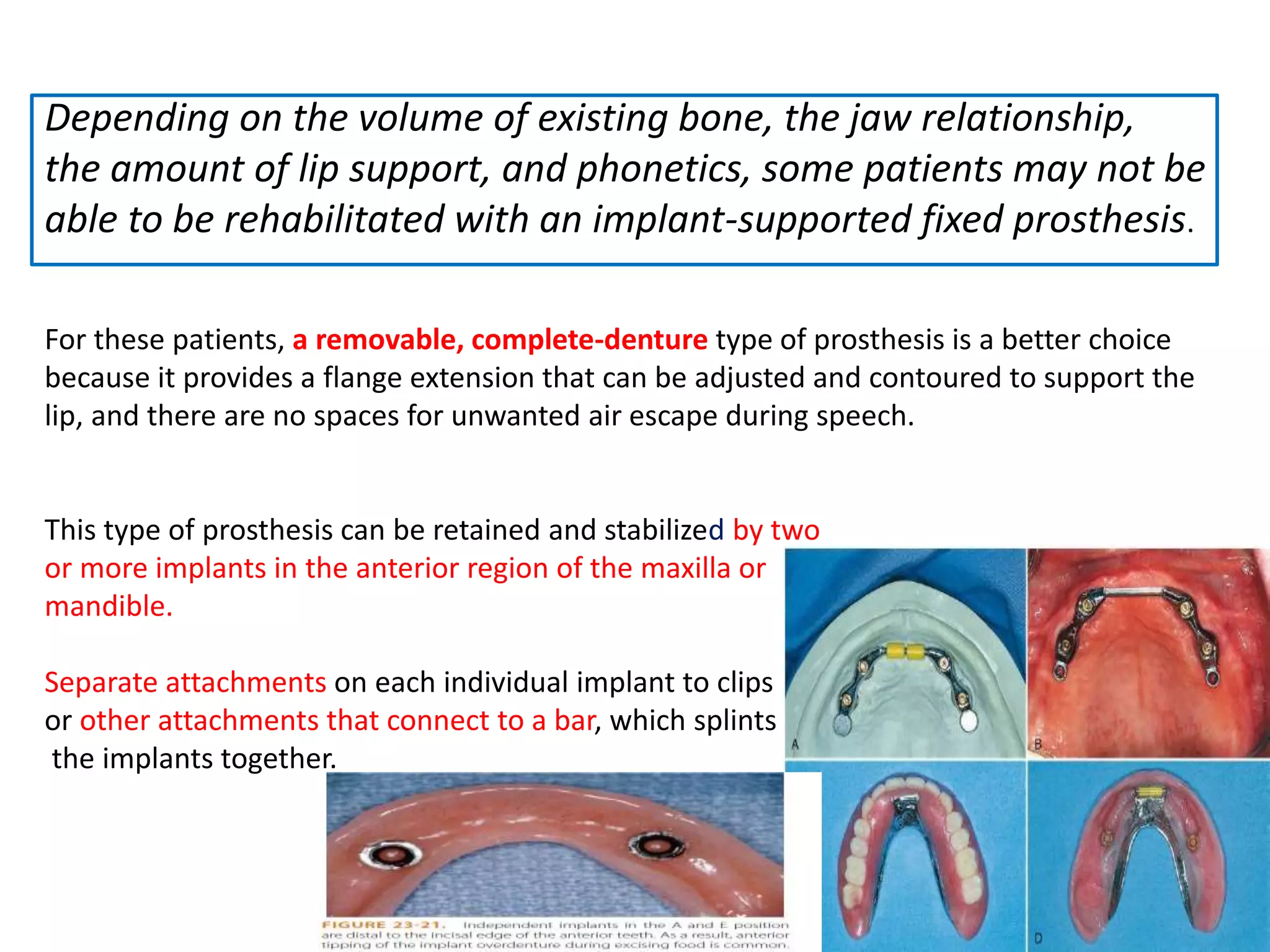 Clinical evaluation of the implant patient | PPTX