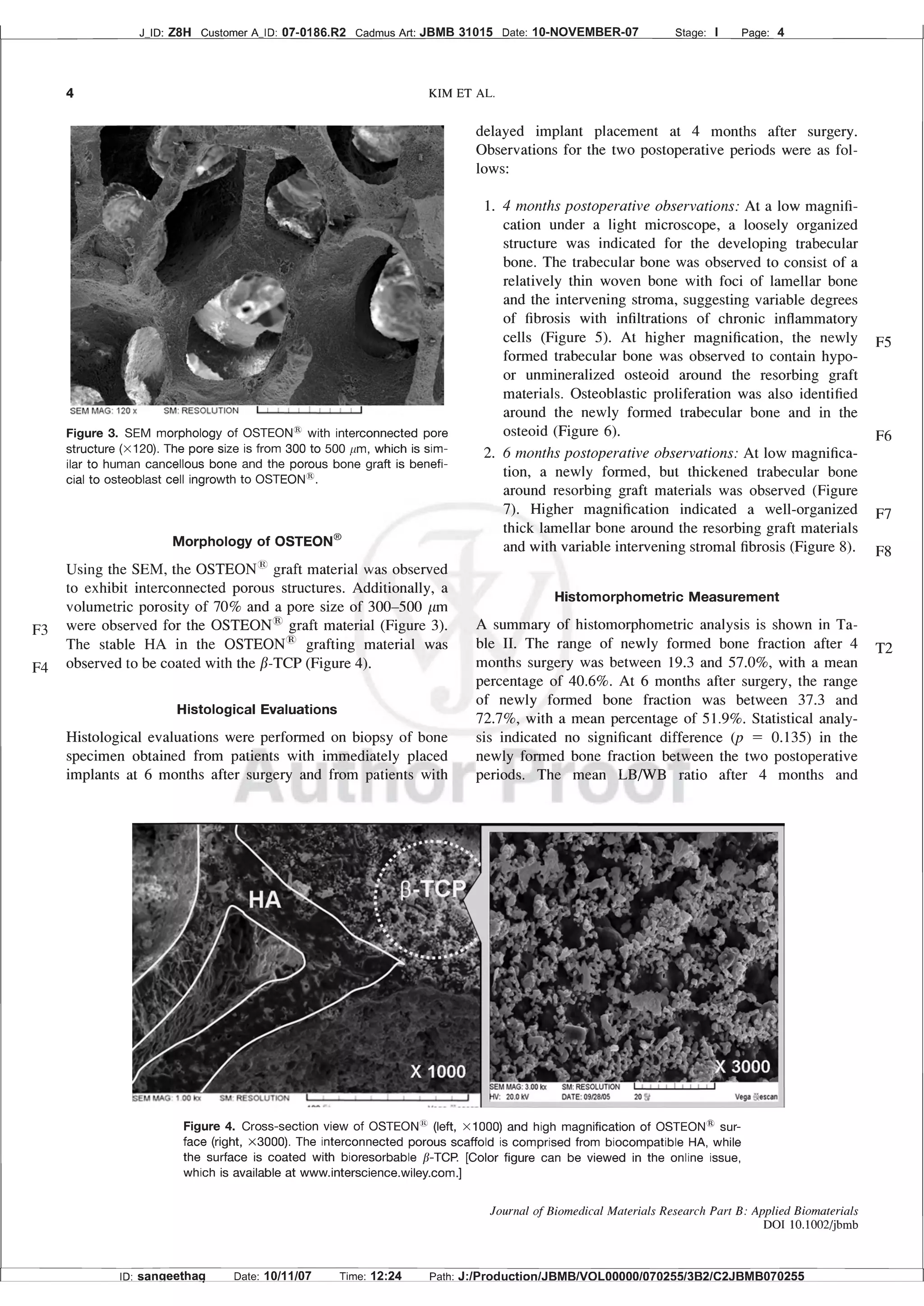 Clinical evaluations of osteon as a new alloplastic material in sinus ...