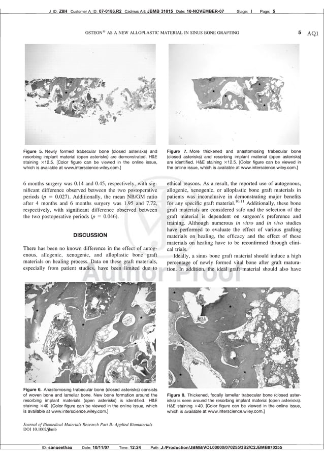 Clinical evaluations of osteon as a new alloplastic material in sinus ...