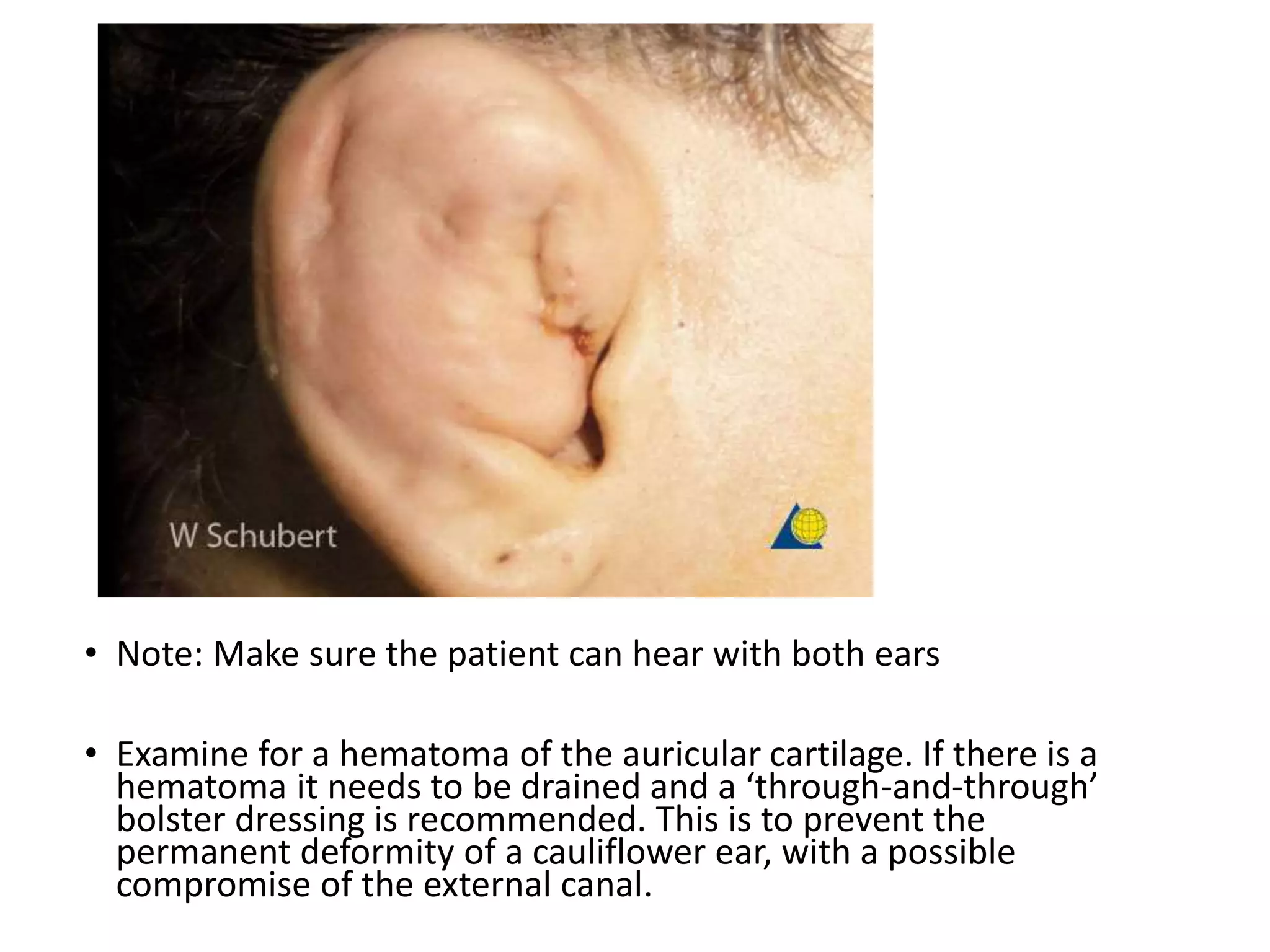 Clinical Evaluation in Maxillofacial Trauma | PPTX