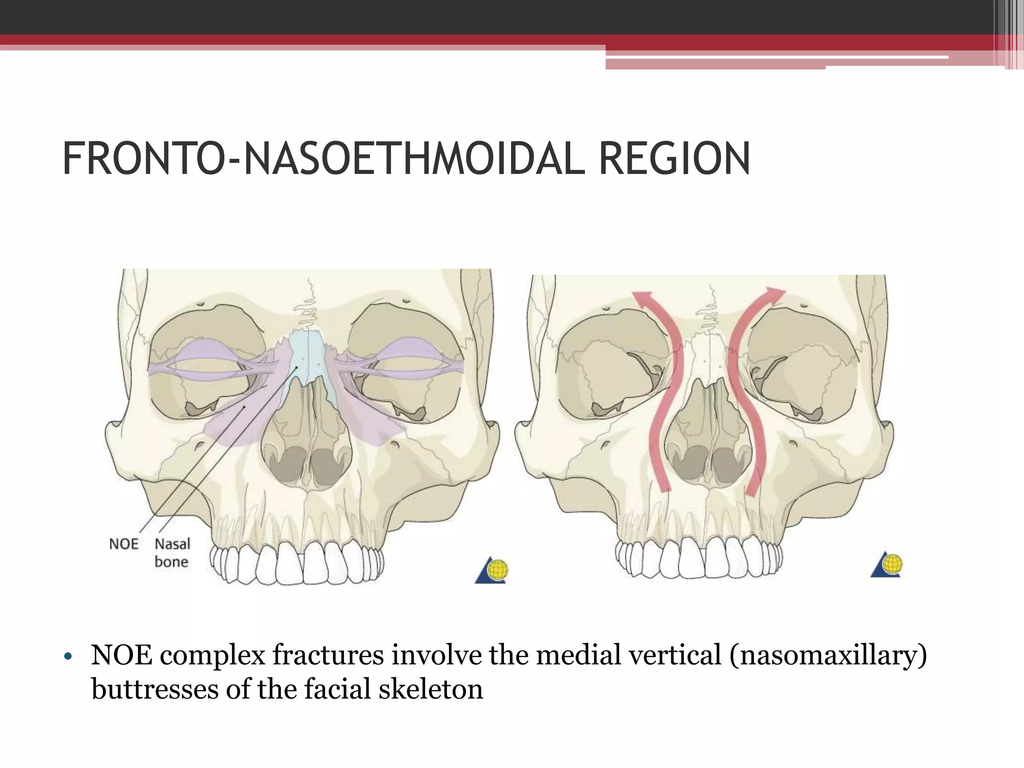 Clinical Evaluation in Maxillofacial Trauma | PPTX