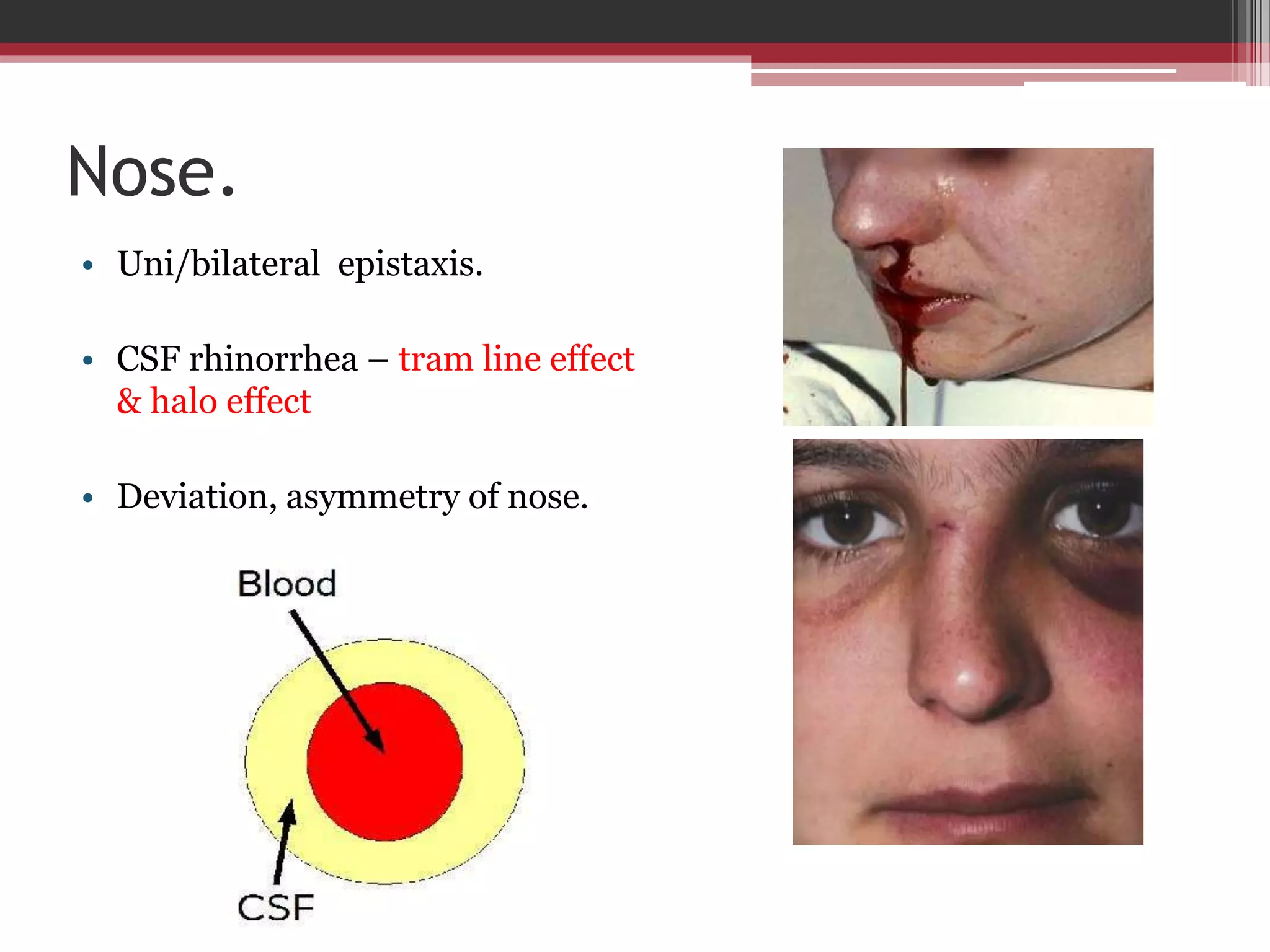 Clinical Evaluation in Maxillofacial Trauma | PPTX