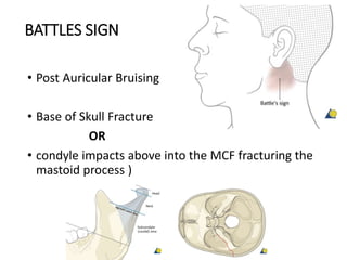 Clinical Evaluation in Maxillofacial Trauma | PPTX