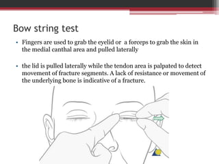 Clinical Evaluation in Maxillofacial Trauma | PPTX