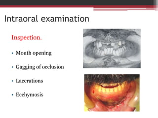 Clinical Evaluation in Maxillofacial Trauma | PPTX
