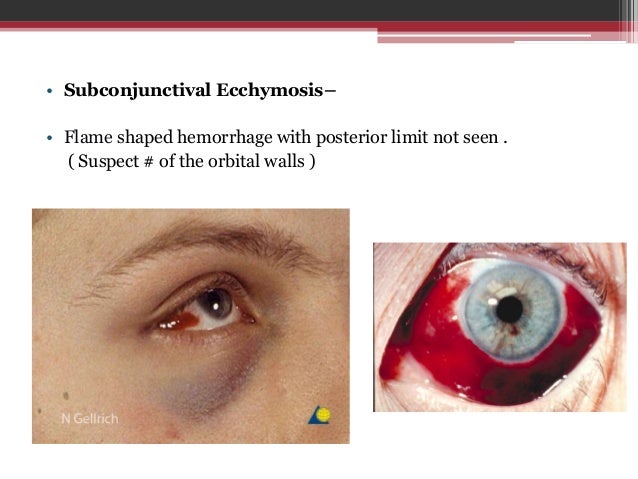 Clinical Evaluation in Maxillofacial Trauma