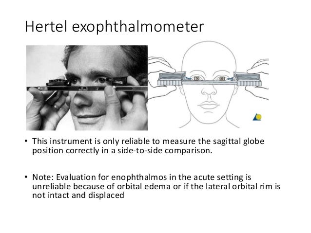 Clinical Evaluation in Maxillofacial Trauma