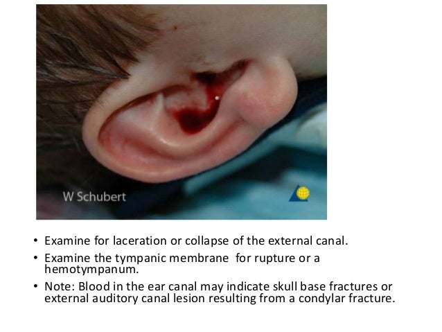 Clinical Evaluation in Maxillofacial Trauma