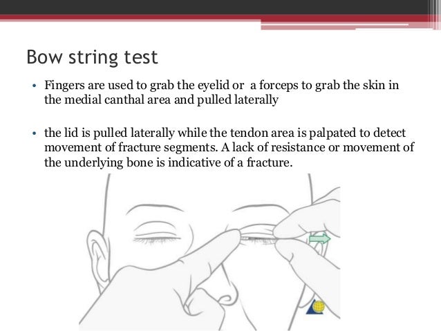 Clinical Evaluation in Maxillofacial Trauma