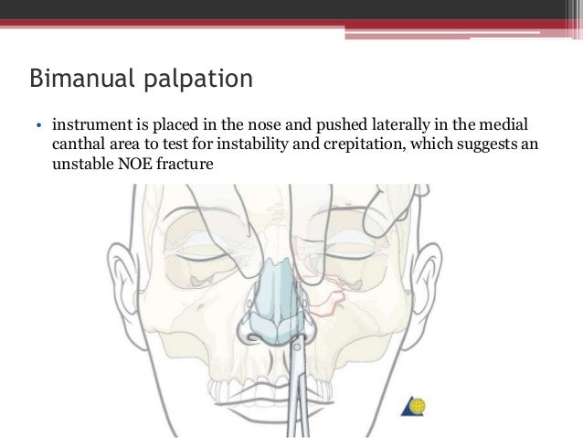 Clinical Evaluation in Maxillofacial Trauma