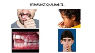 CLINICAL EXAMINATION IN ORTHODONTICS.pptx
