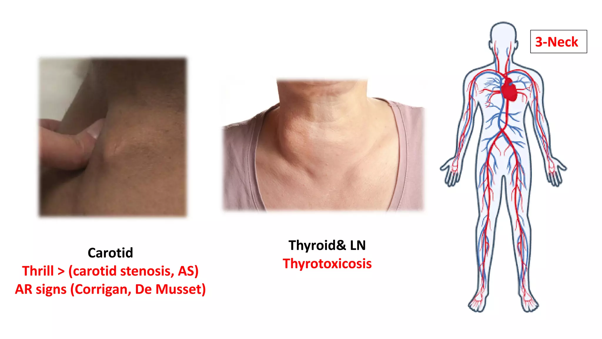 Cardiac examination | PDF