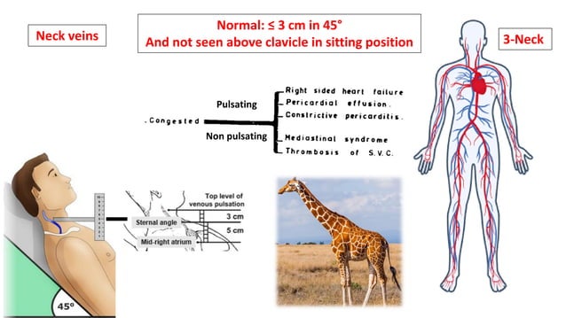Cardiac examination | PDF | Heart and Cardiovascular Diseases ...
