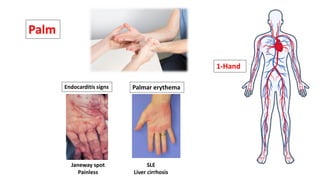 Cardiac examination | PDF