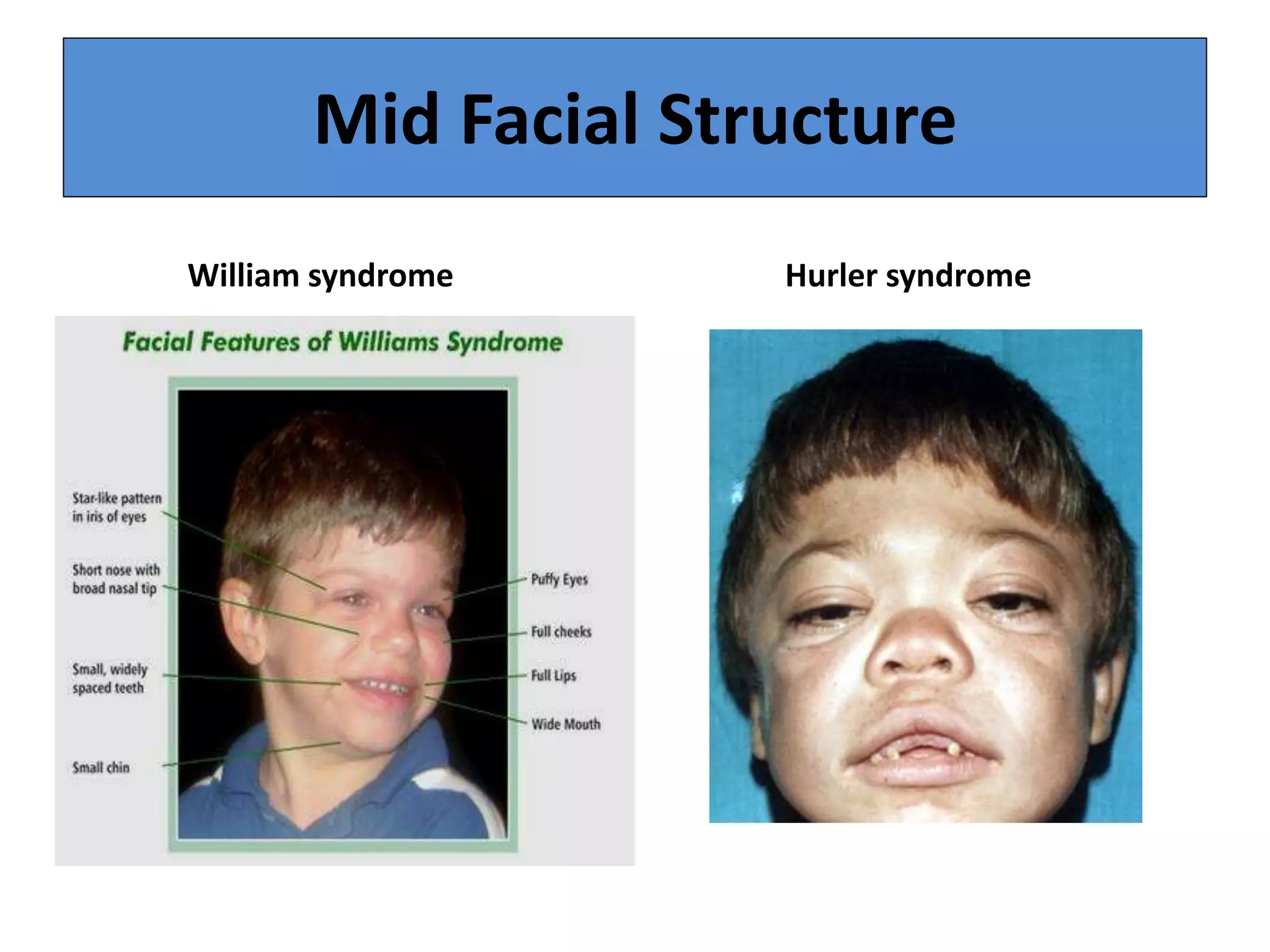 Clinical examination of Endocrine system | PPTX