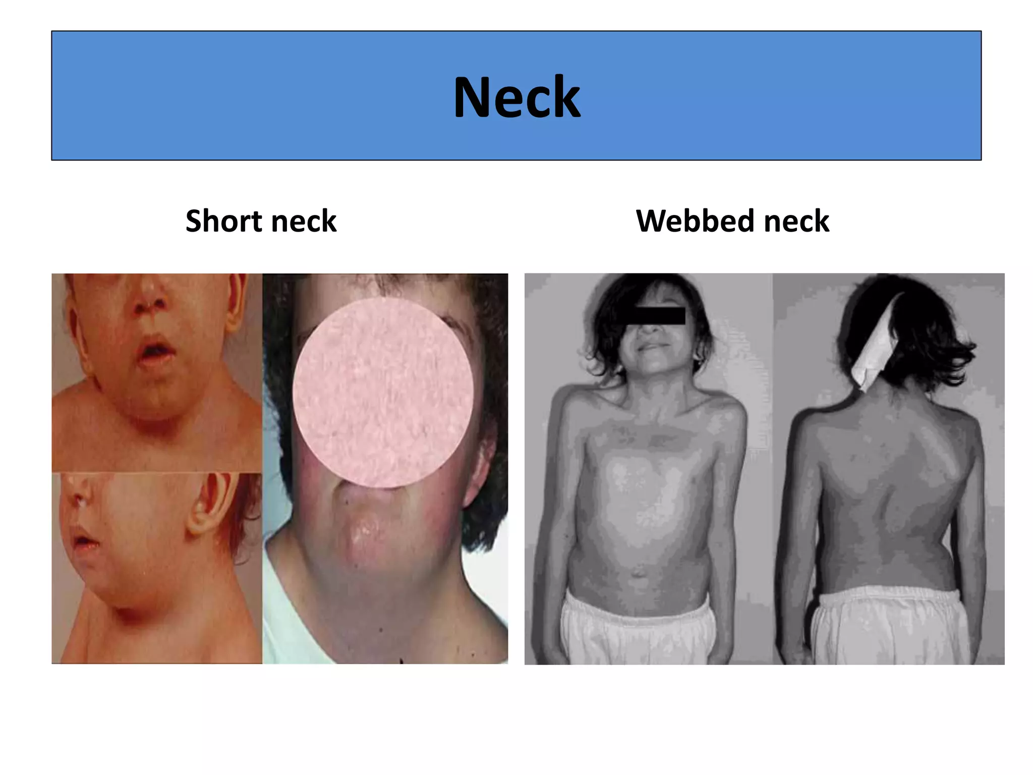 Clinical examination of Endocrine system | PPTX