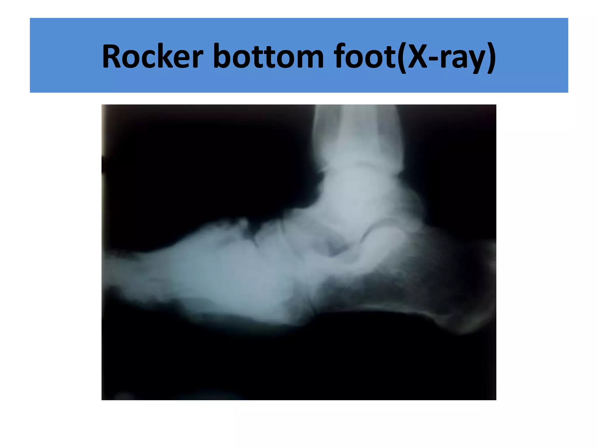 Clinical examination of Endocrine system | PPTX