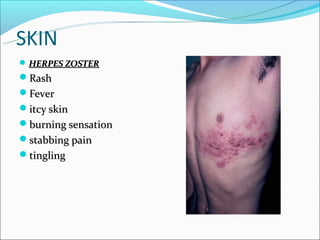 Clinical examination chest pain | PPT