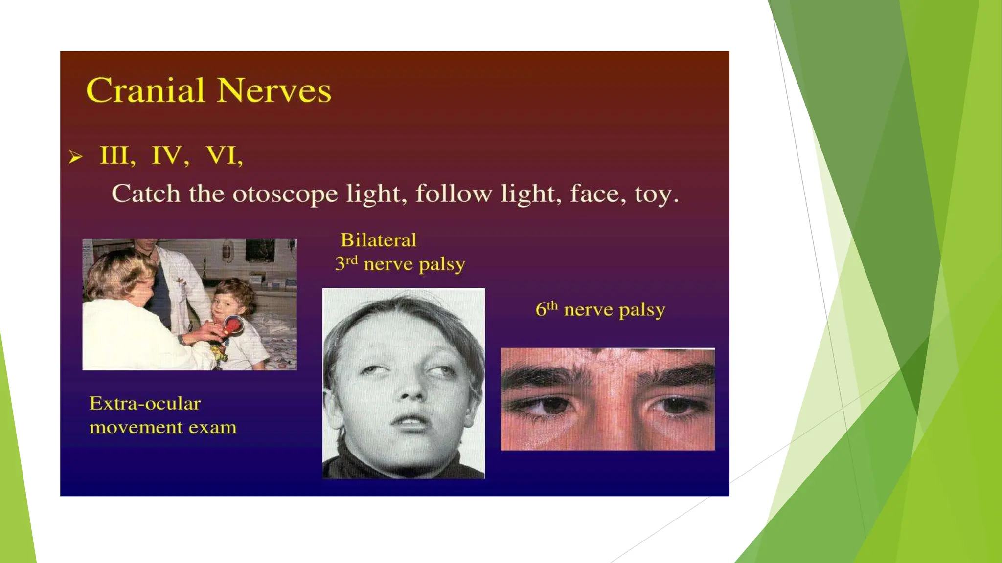 Clinical examination of- -CRANIAL nerves | PPT