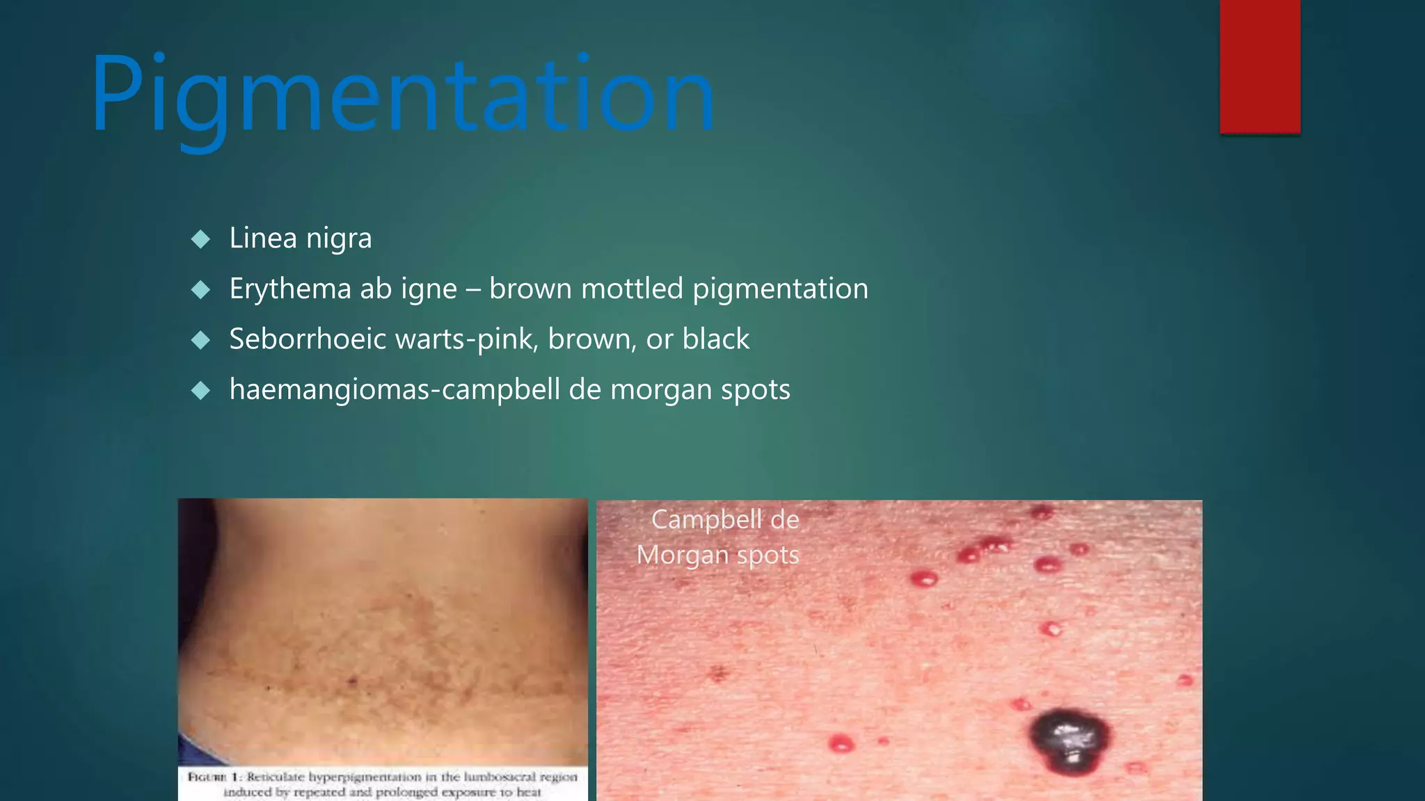 Clinical examination of abdomen medicine | PPTX