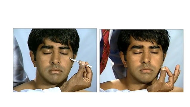 CLINICAL EXAMINATION OF CRANIAL NERVES I TO XII | PPT