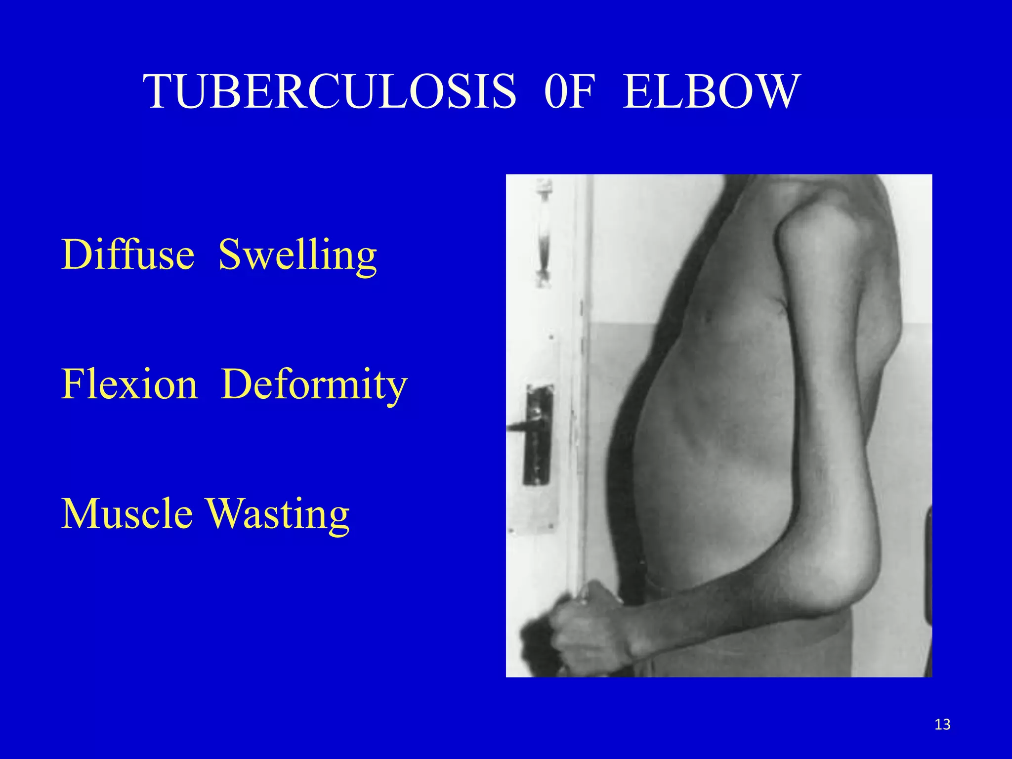 Clinical examination of elbow joint | PPTX