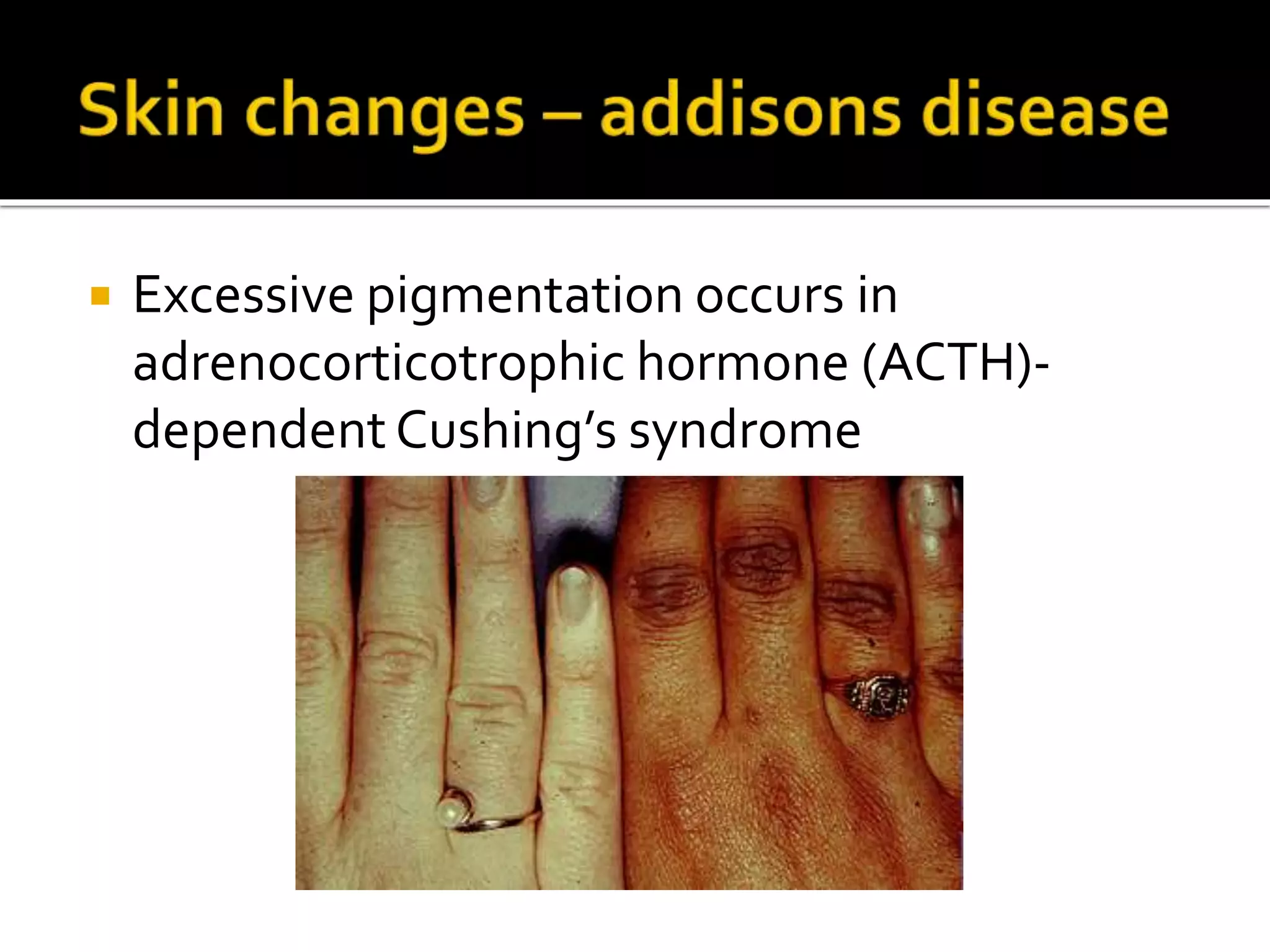 Clinical examination of endocrine system | PPTX