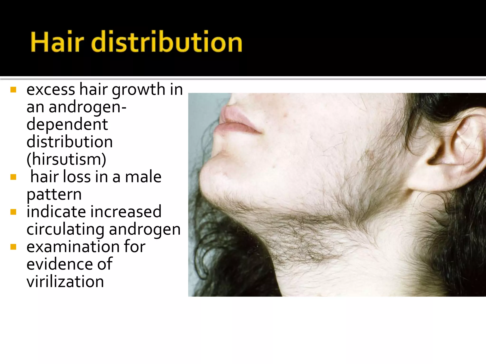 Clinical examination of endocrine system | PPTX